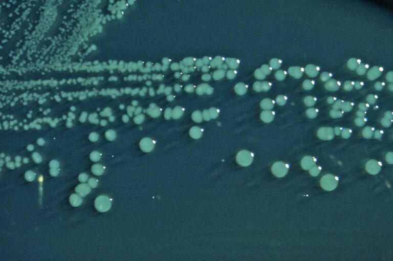 Shigella | Concise Medical Knowledge