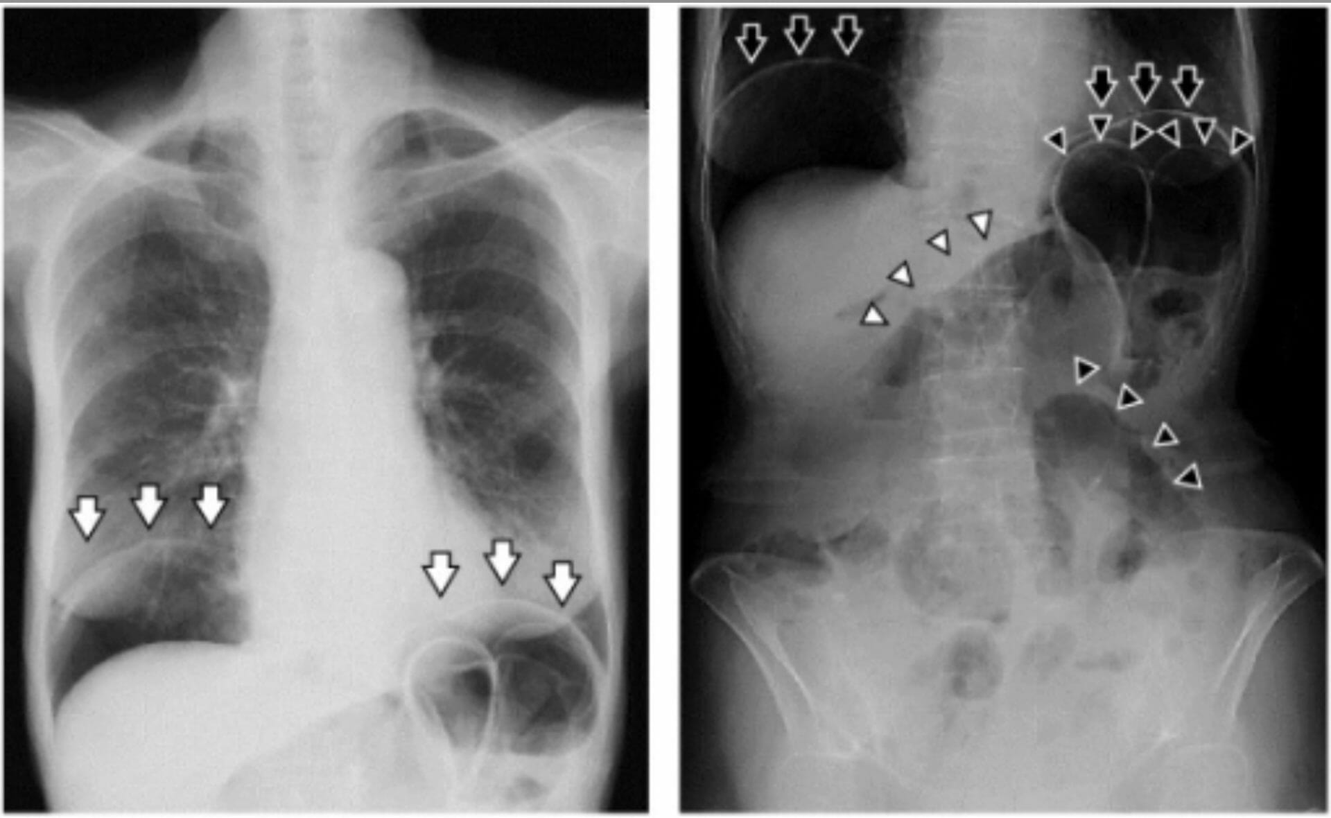 Imagenología Intestinal | Concise Medical Knowledge