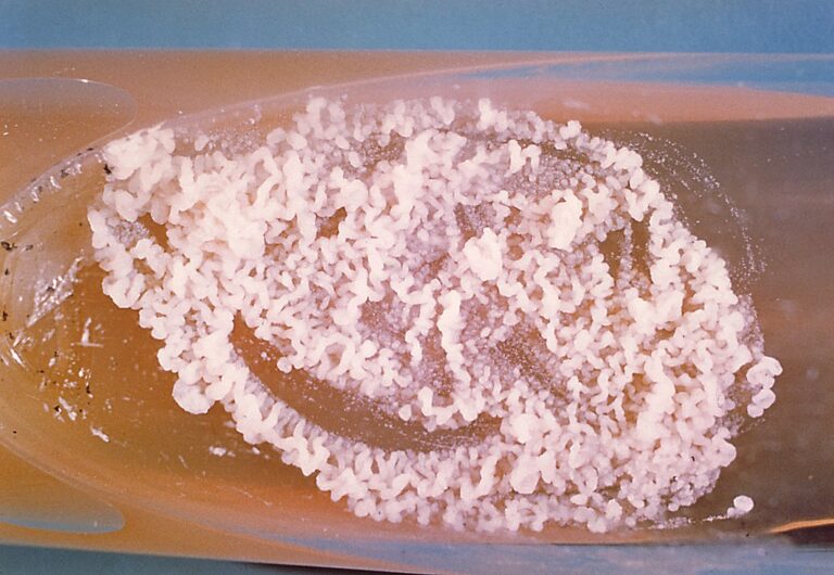 Paracoccidioides/Paracoccidioidomycosis | Concise Medical Knowledge