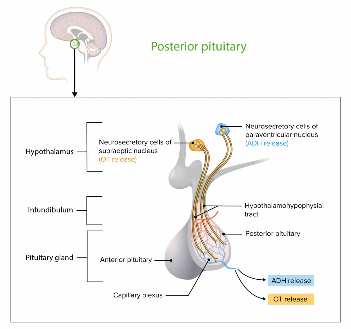 Síndrome de Secreción Inapropiada de la Hormona Antidiurética (SIADH ...