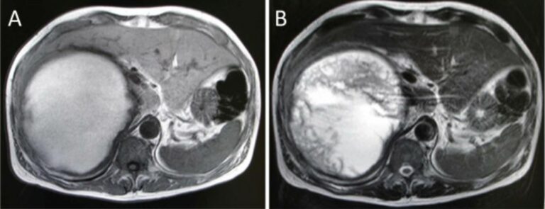 Magnetic Resonance Imaging (MRI) | Concise Medical Knowledge
