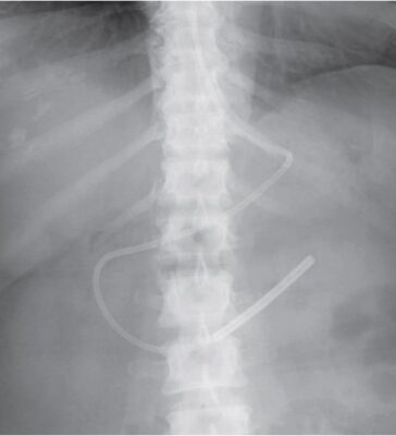 X-rays | Concise Medical Knowledge