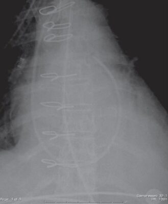 X-rays | Concise Medical Knowledge