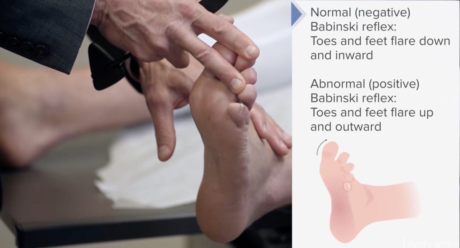 Neurological Examination | Concise Medical Knowledge