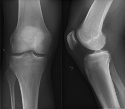 X-rays | Concise Medical Knowledge