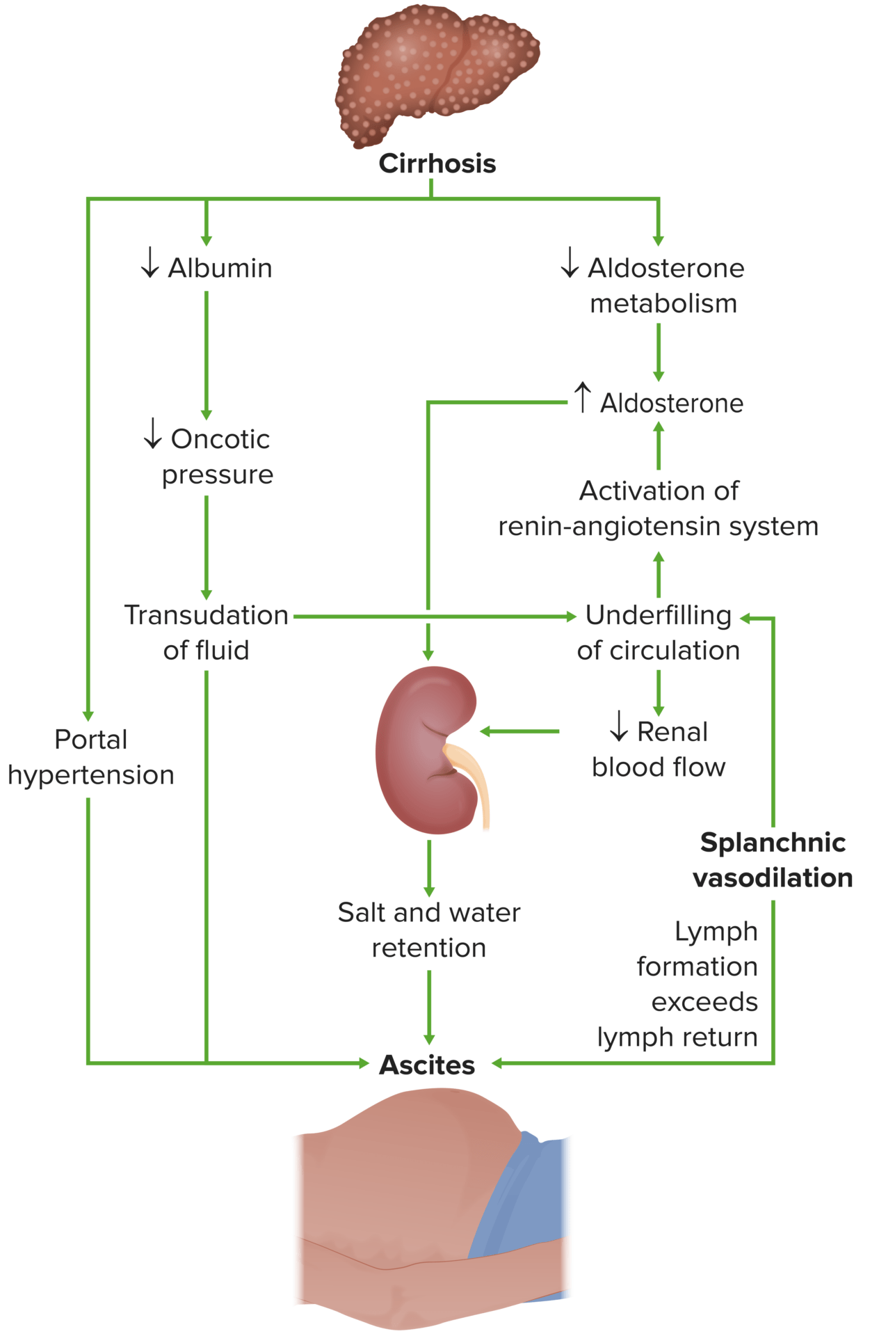 Ascites | Concise Medical Knowledge
