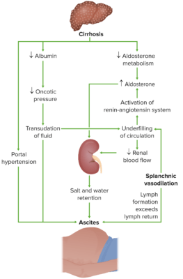 Ascite | Concise Medical Knowledge