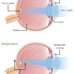 Concept Cards | Concise Medical Knowledge