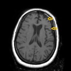 Magnetic Resonance Imaging (MRI) | Concise Medical Knowledge