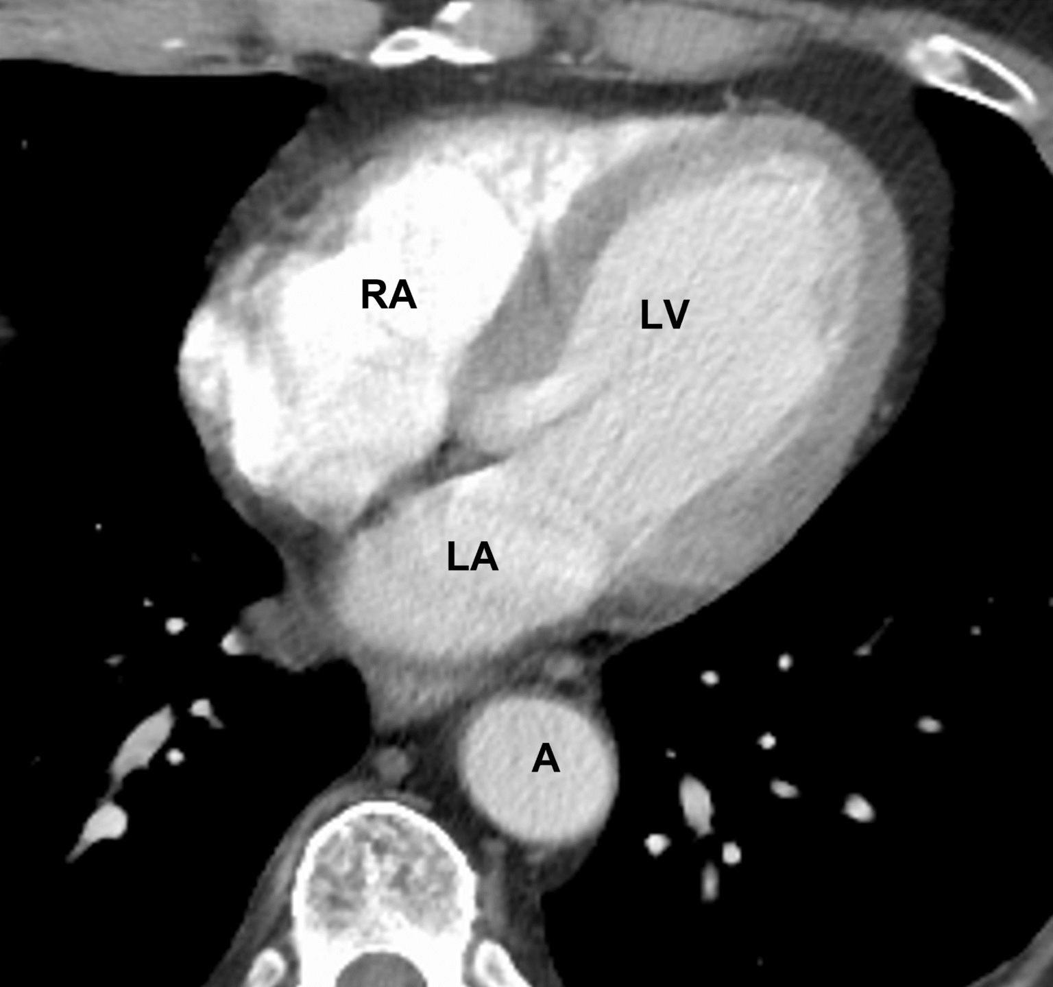 Imaging of the Heart and Great Vessels | Concise Medical Knowledge