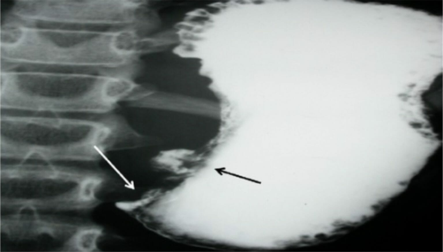 Imagenología Intestinal | Concise Medical Knowledge
