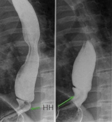 Imagenología Intestinal | Concise Medical Knowledge