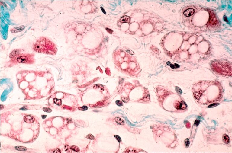 Adipose Tissue: Histology | Concise Medical Knowledge
