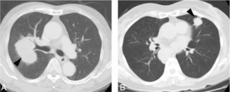 Tomografia Computorizada (TC) | Concise Medical Knowledge