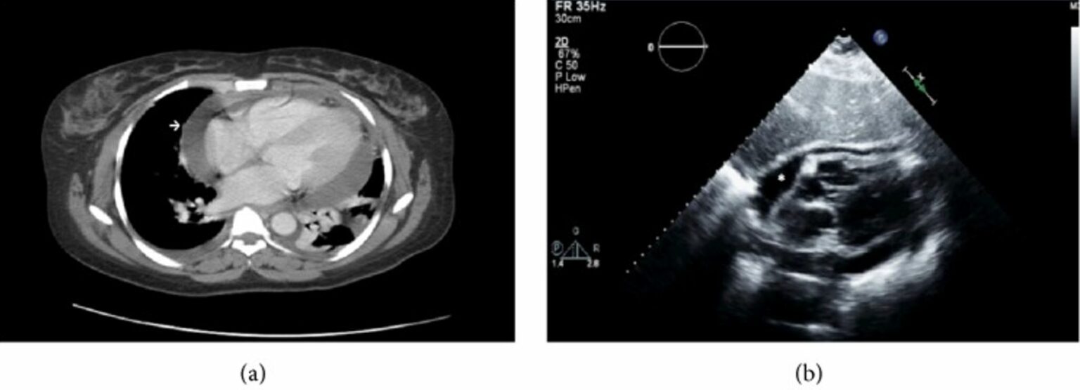 Imaging of the Heart and Great Vessels | Concise Medical Knowledge