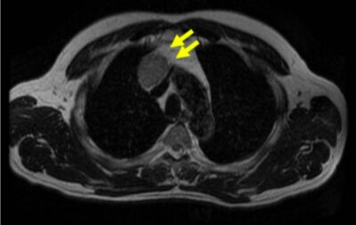 Imaging of the Lungs and Pleura | Concise Medical Knowledge
