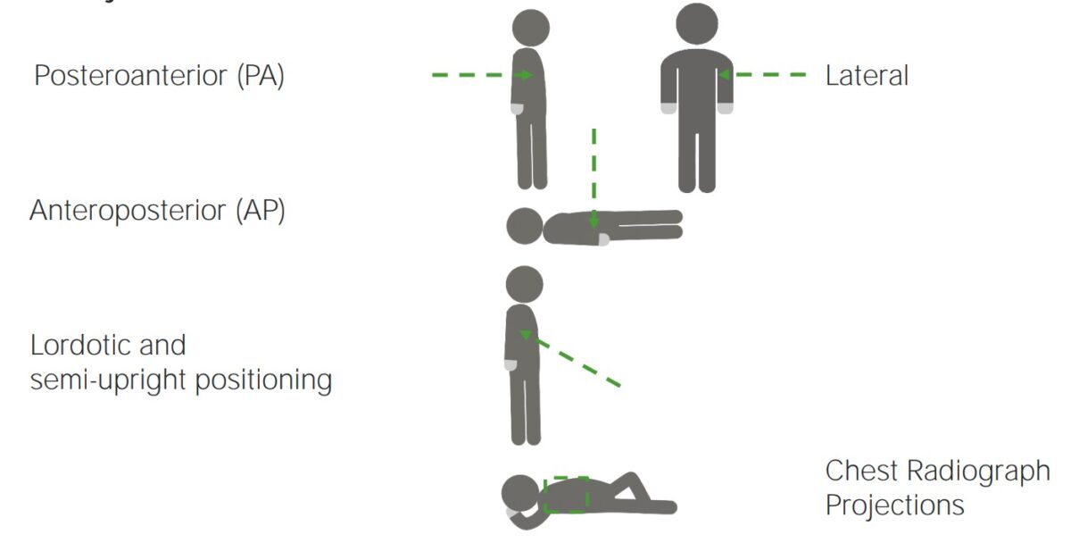 Rayos X | Concise Medical Knowledge