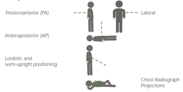 Rayos X | Concise Medical Knowledge