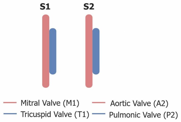 Heart Sounds | Concise Medical Knowledge
