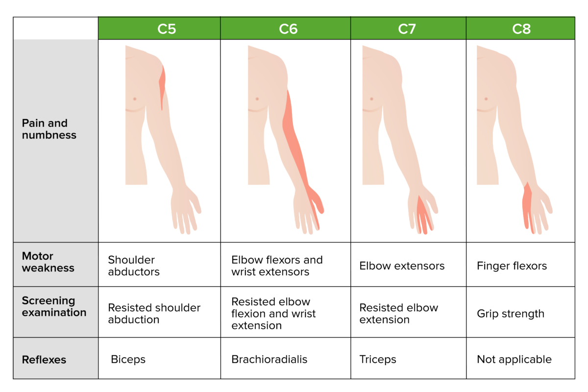 Neck Pain | Concise Medical Knowledge