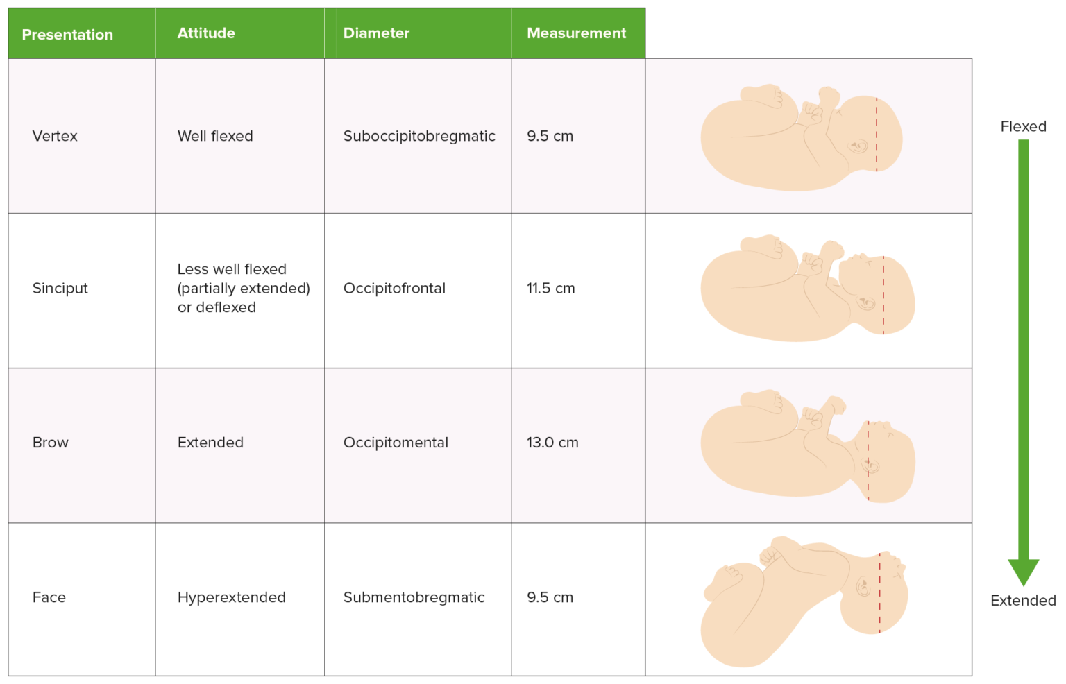 Fetal Malpresentation and Malposition | Concise Medical Knowledge