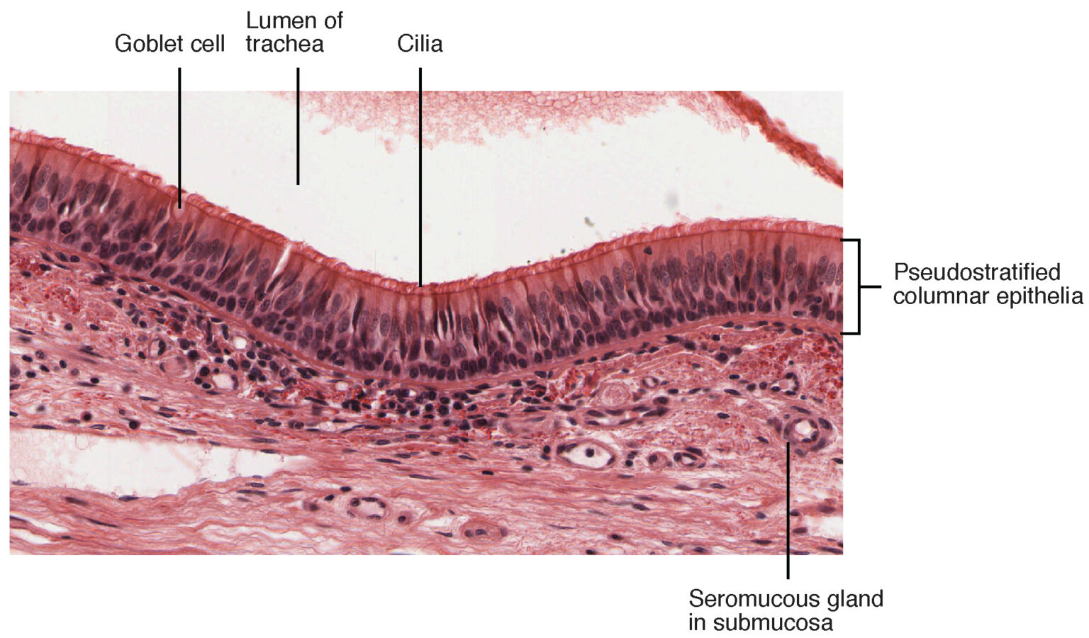 Epitélio de Superfície: Histologia | Concise Medical Knowledge