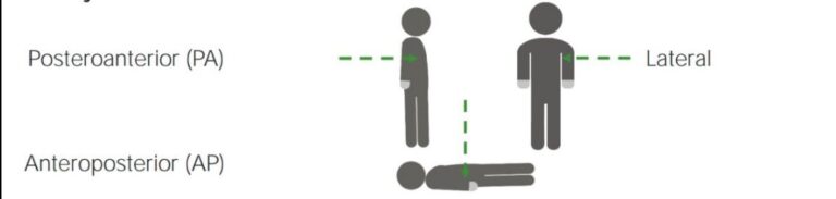 Imaging of the Lungs and Pleura | Concise Medical Knowledge
