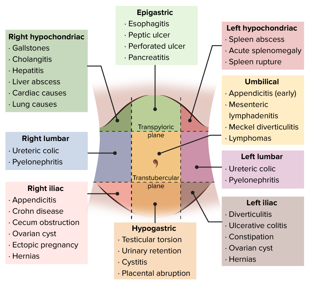 Acute Abdomen Concise Medical Knowledge