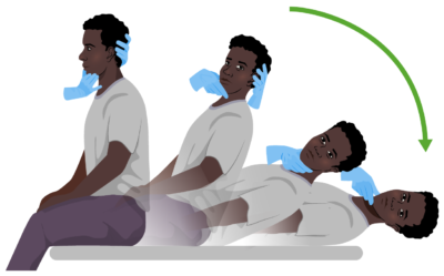 Vertigo | Concise Medical Knowledge