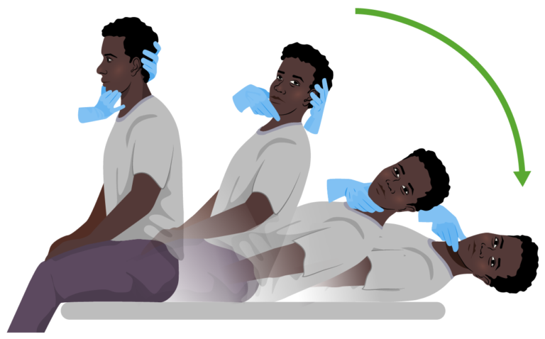 Vertigo | Concise Medical Knowledge