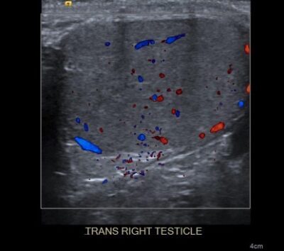 Ultrasonido (Ecografía) | Concise Medical Knowledge