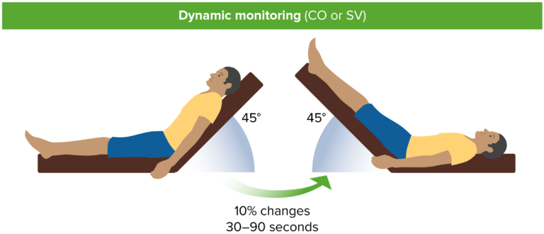 Types of Shock | Concise Medical Knowledge