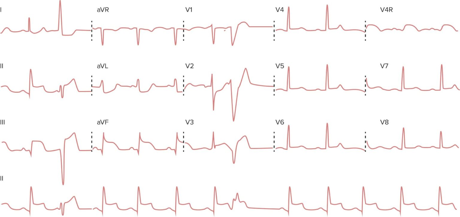 Free USMLE® Step 1 Physiology Questions
