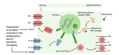 Hyperaldosteronism | Concise Medical Knowledge