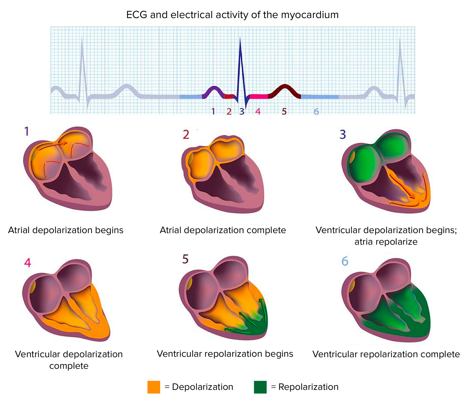 Tachyarrhythmias | Concise Medical Knowledge