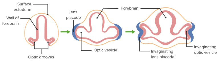 Eye: Anatomy | Concise Medical Knowledge