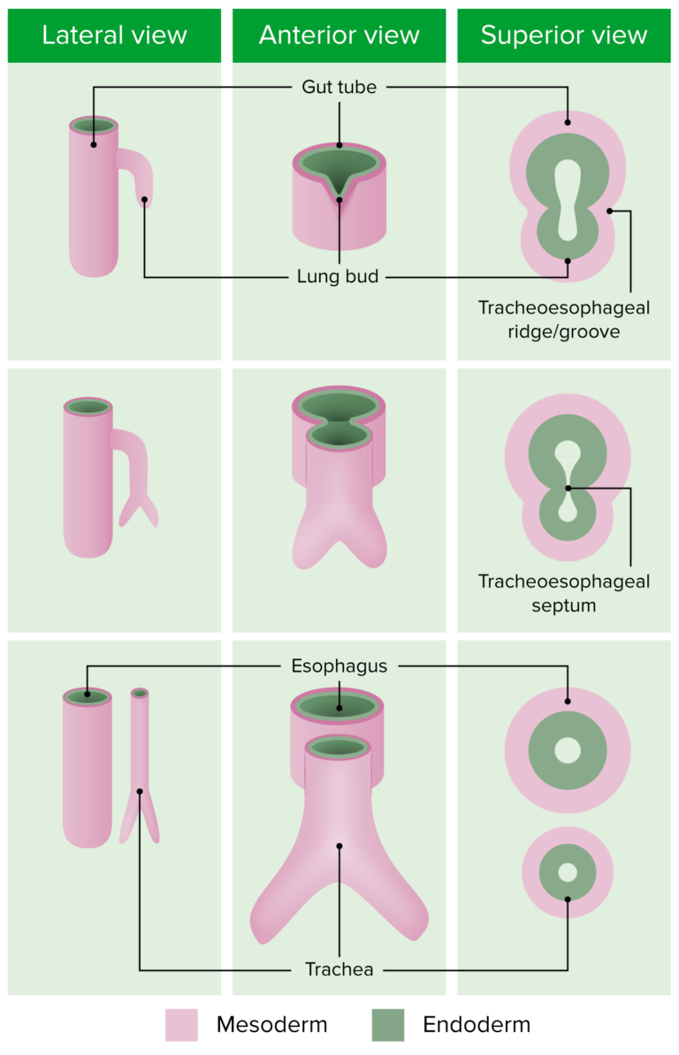 Trachea: Anatomy | Concise Medical Knowledge