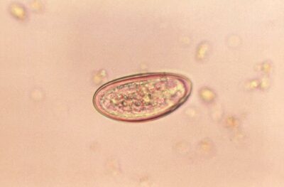 Enterobius/Enterobiasis | Concise Medical Knowledge