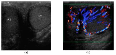 Scrotal Imaging | Concise Medical Knowledge