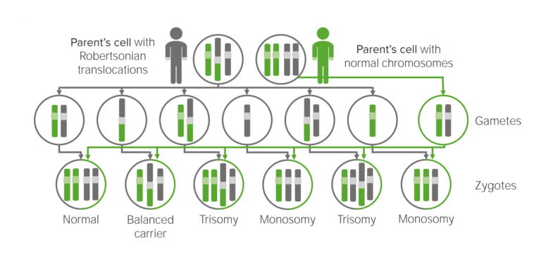 Patau Syndrome (Trisomy 13) | Concise Medical Knowledge