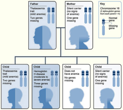 Thalassemia | Concise Medical Knowledge