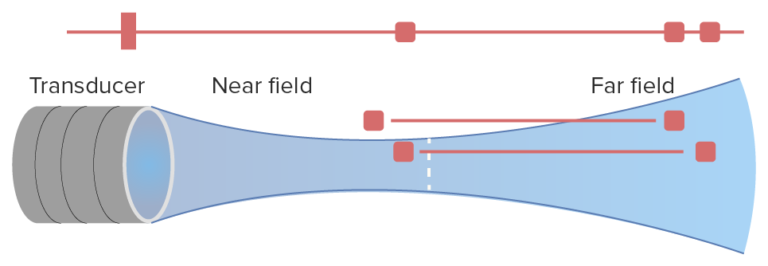 Ultrasound (Sonography) | Concise Medical Knowledge