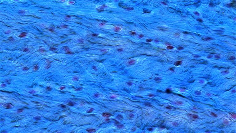 Cartilage: Histology | Concise Medical Knowledge
