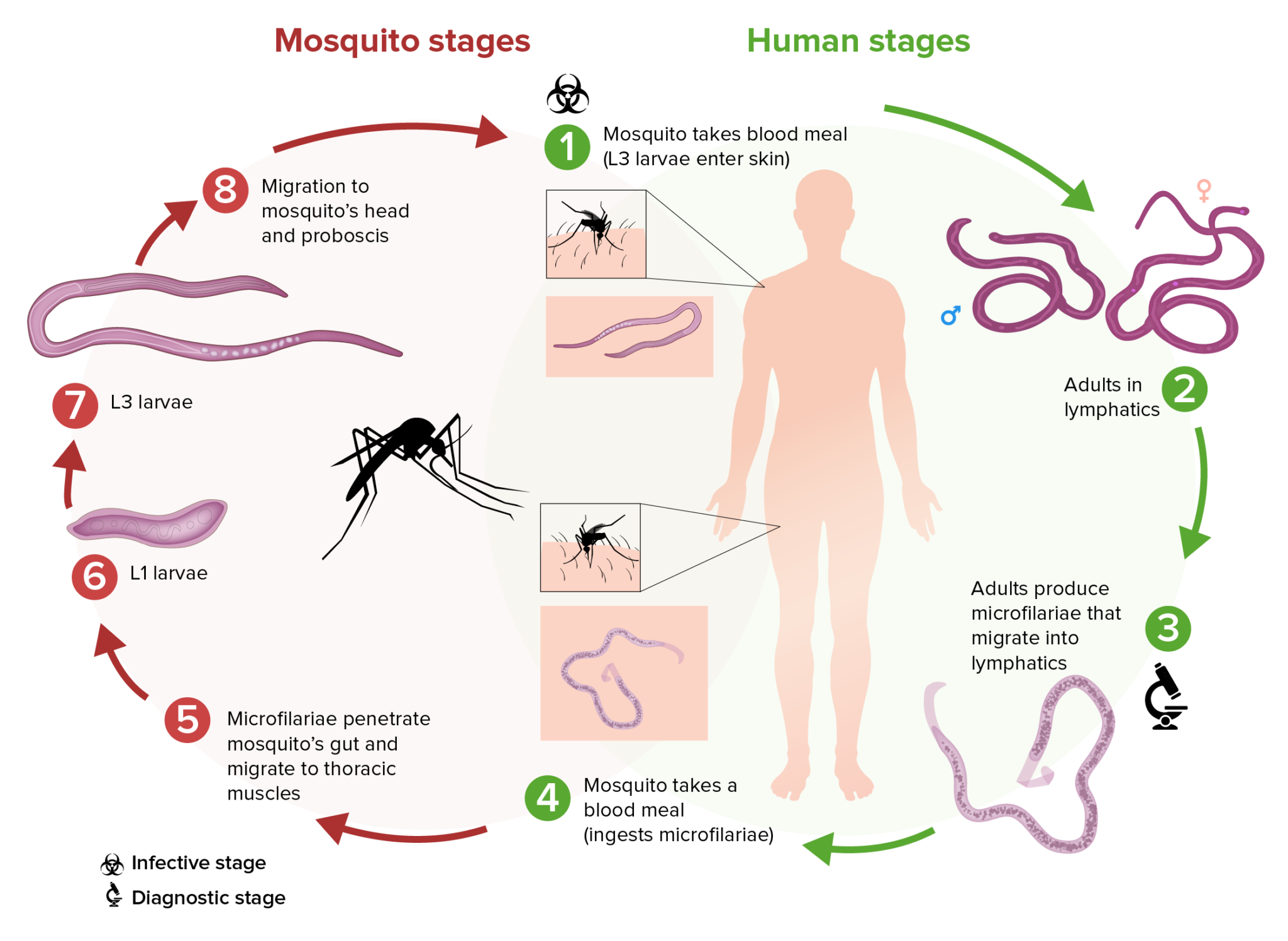 Lymphatic Filariasis (Elephantiasis) | Concise Medical Knowledge