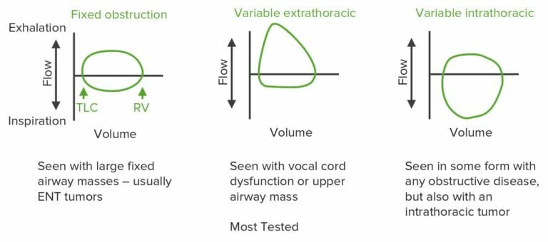Pulmonary Function Tests | Concise Medical Knowledge