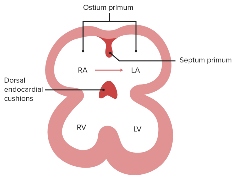 Development of the Heart | Concise Medical Knowledge