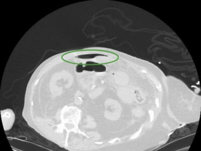 Imaging of the Intestines | Concise Medical Knowledge