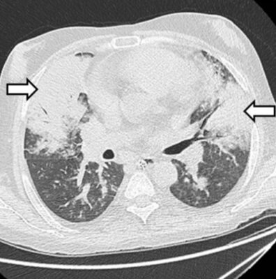 Tomografia Computorizada (TC) | Concise Medical Knowledge