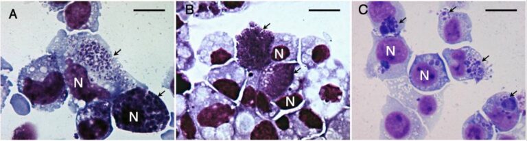 Ehrlichiosis and Anaplasmosis | Concise Medical Knowledge
