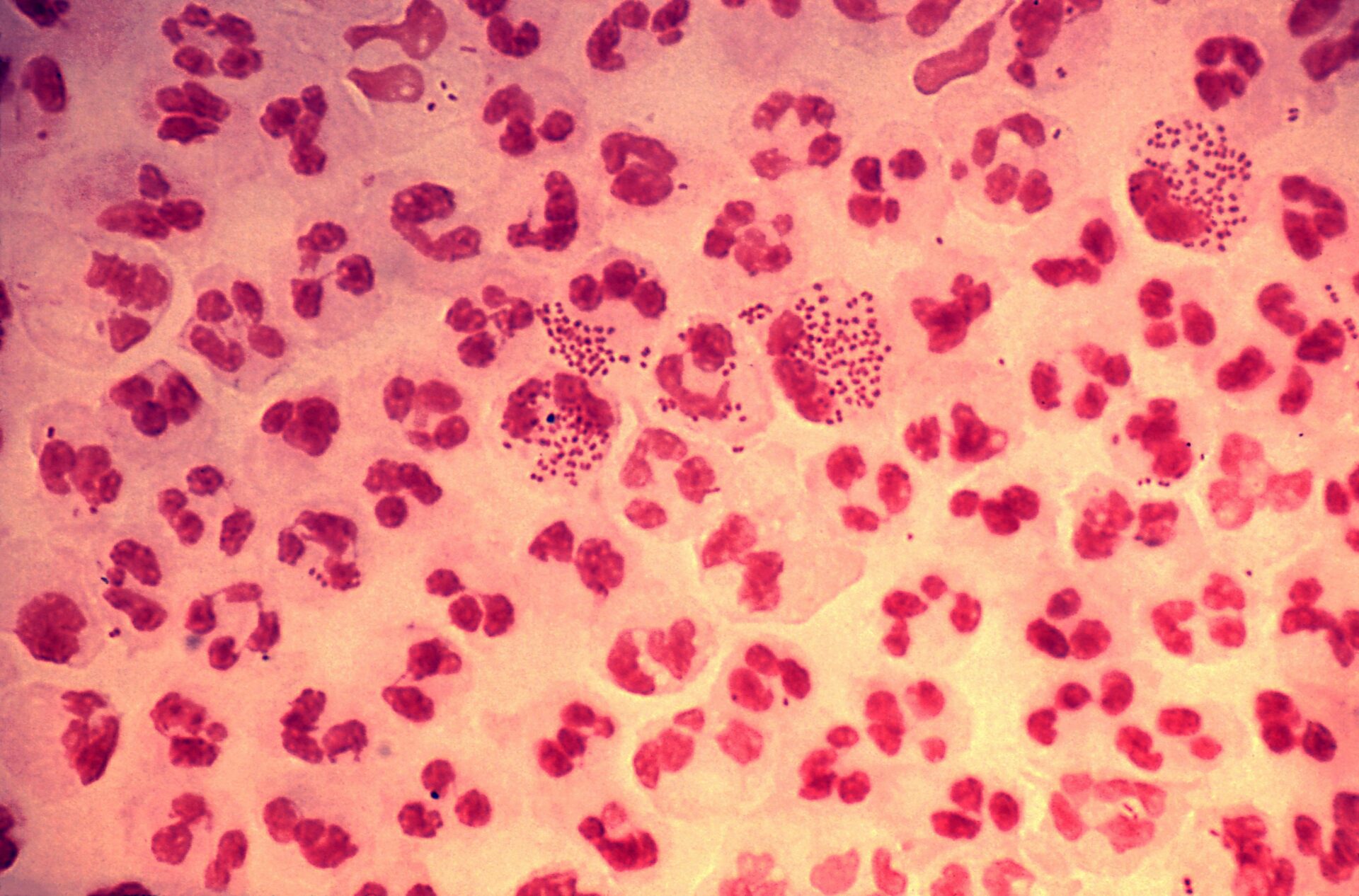 Neisseria | Concise Medical Knowledge Neisseria | Concise Medical Knowledge